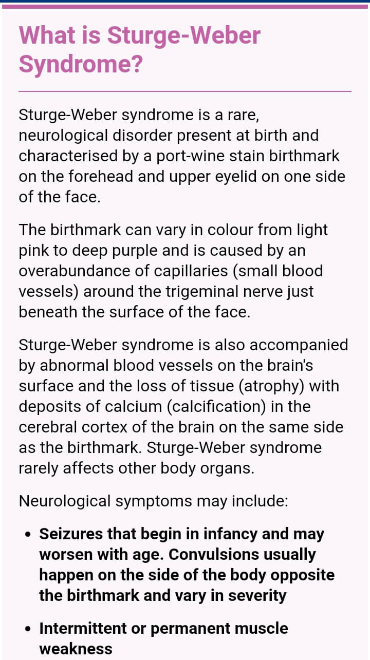 What is Sturges-weber Syndrome? Mum told her baby daughter's birthmark ...