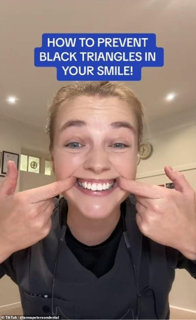 What it means IF you have 'black triangles' between your teeth - and ...