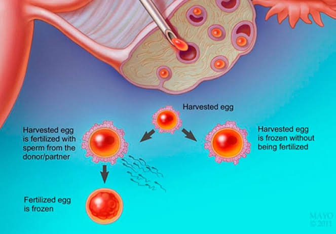 Trans man and his female partner will undergo NHS-funded IVF using her ...